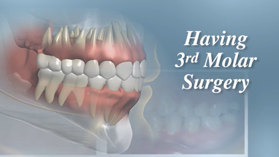 Oral Surgery Videos Lake Oswego OR, AAOMS Videos, Online Videos